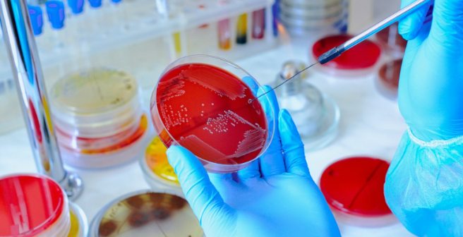 Style tips for presenting scientific names of bacteria | Editage Insights